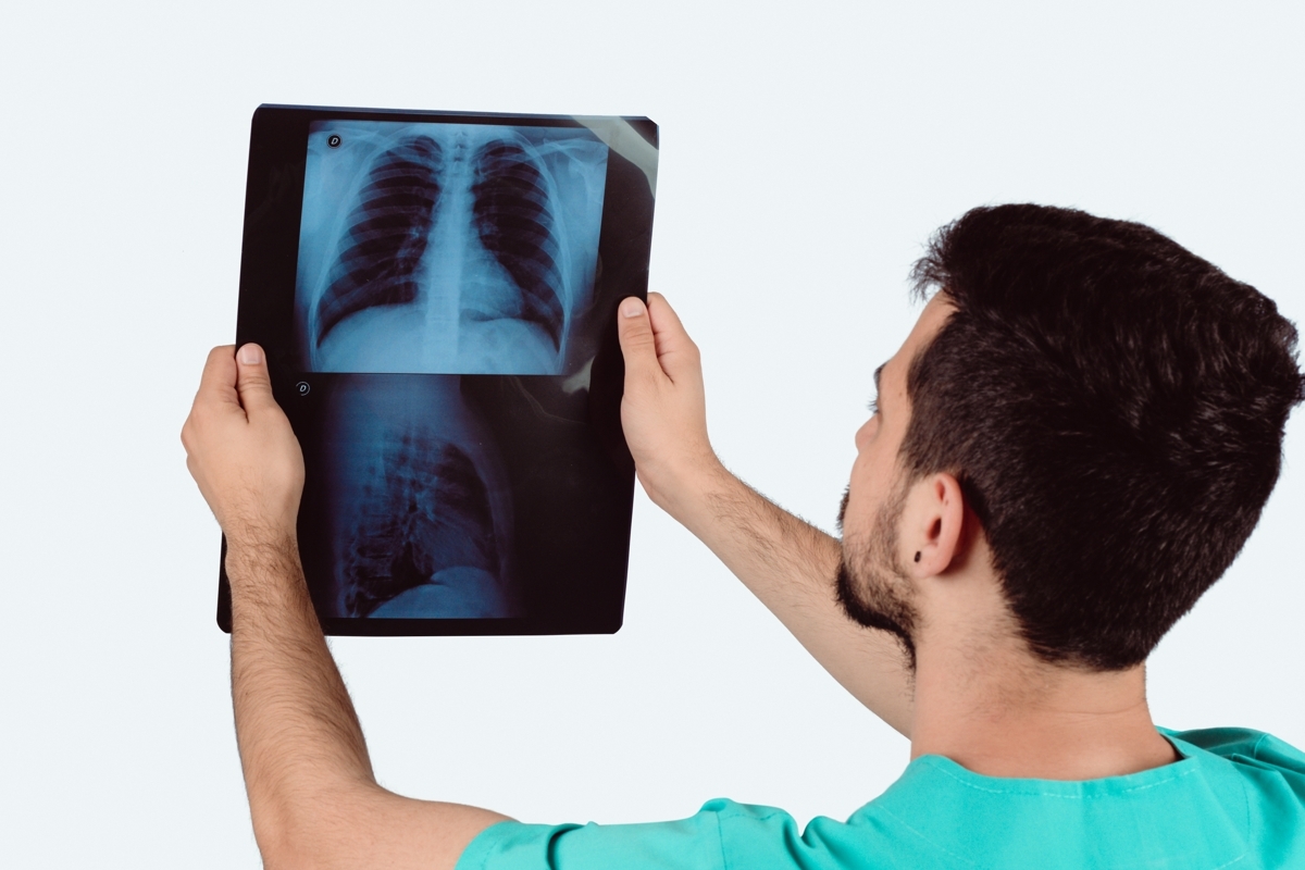 Patient education series: Rib Fractures – TSN 2025